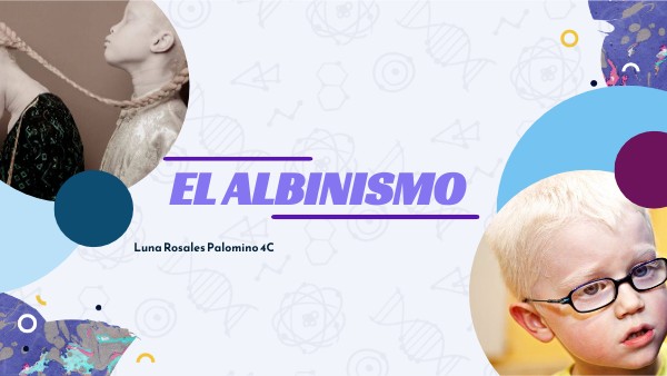EL ALBINISMO