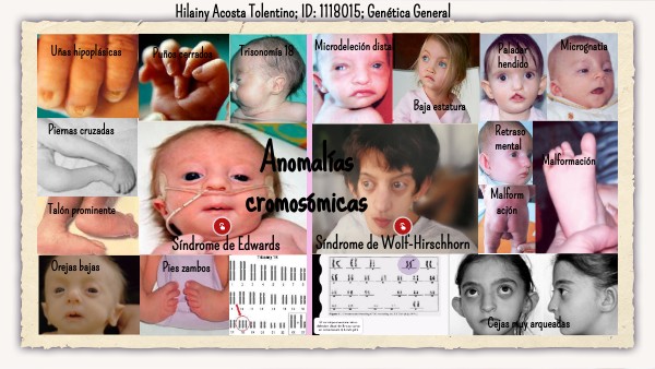 Anomalías Cromosómicas | Genially