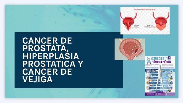 CANCER DE PROSTATA | Genially