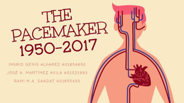 PACEMAKER