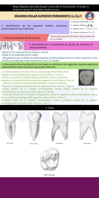 Infografía,Segundo molar superior. Alejandro Quevedo Duque. 040-21-524 ...