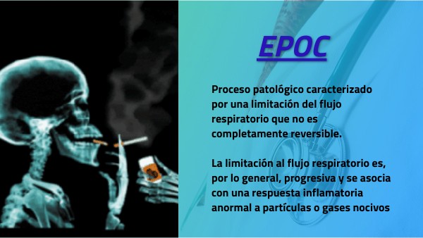 EPOC | Genially
