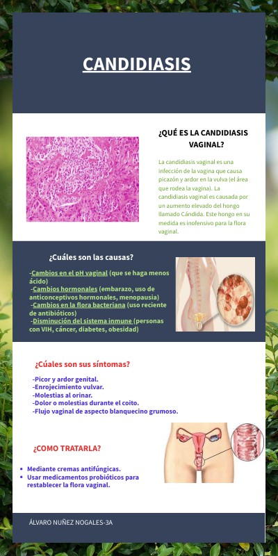 Candidiasis