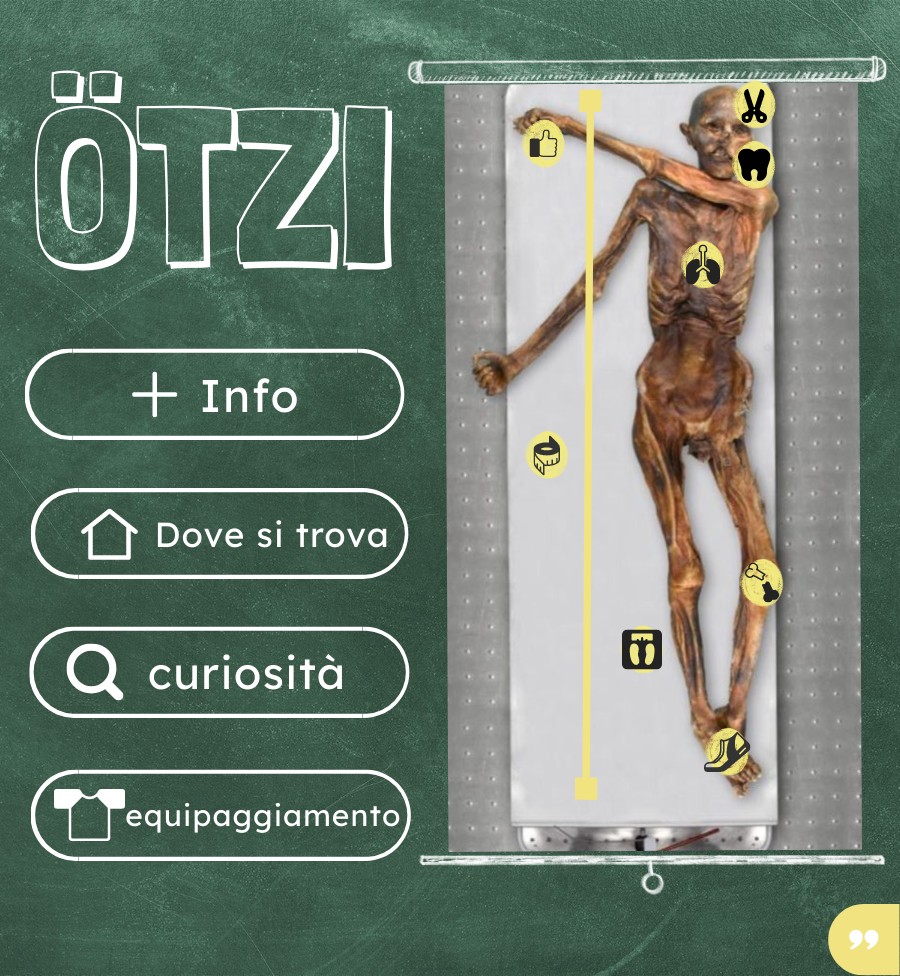 Ötzi