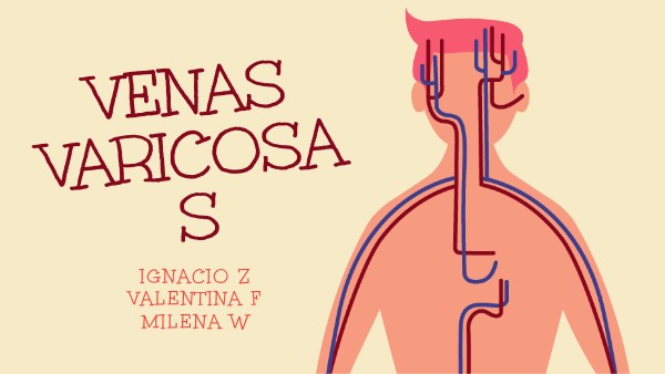 PRESENTACIÓN VENAS VARICOSAS | Genially