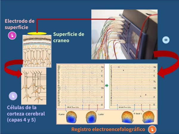 electrodos de superficie/ electroencefalogram | Genially