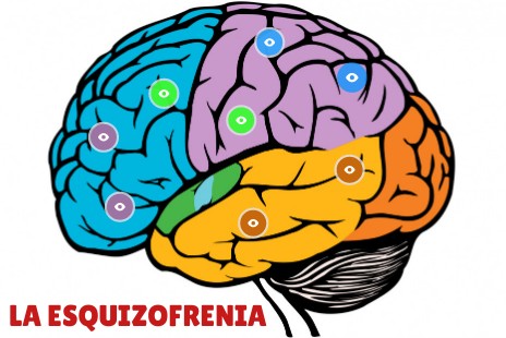 La Esquizofrenia