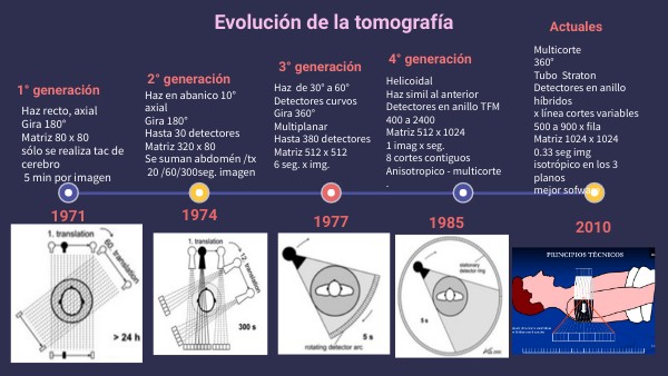 EVOLUCIÓN DE LA TOMOGRAFÍA | Genially