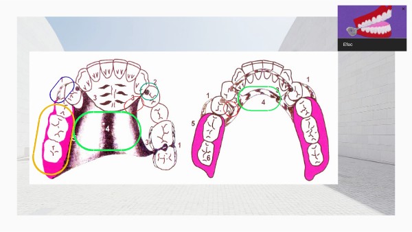 IMAGEN INTERACTIVA partes PPR básico