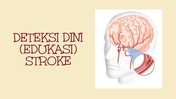 Detksi Dini Stroke | Genially