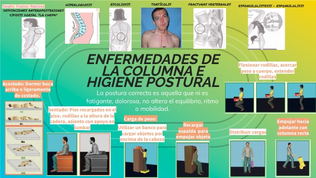 Higiene Postural | Genially