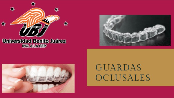 Guardas Oclusales | Genially