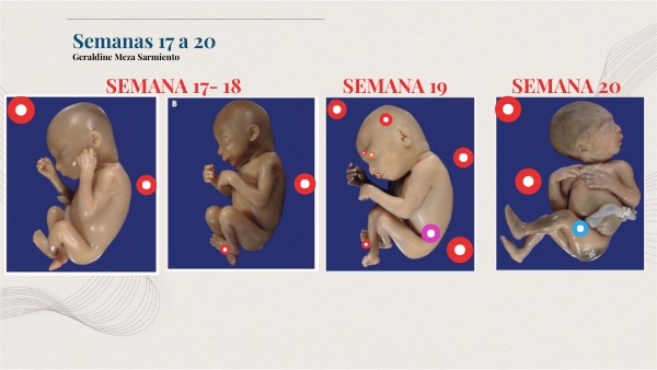 Semanas 17 a 20- GMS