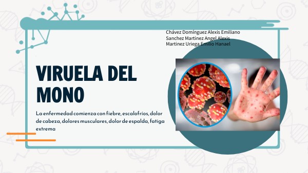 PRESENTACIÓN VIRUELA DEL MONo | Genially