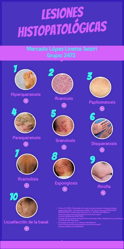 Lesiones Histopatológicas | Genially