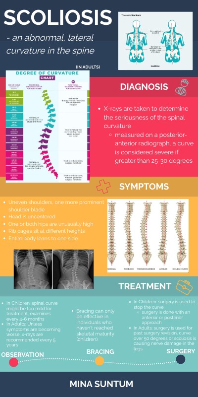 SCOLIOSIS INFOGRAPHIC | Genially