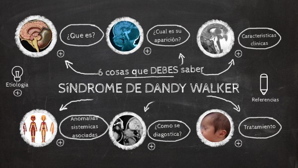 Sindrome de Dandy Walker | Genially