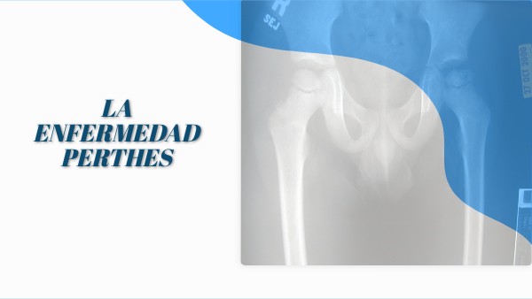 LA ENFERMEDAD PERTHES