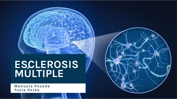 Esclerosis Multiple | Genially