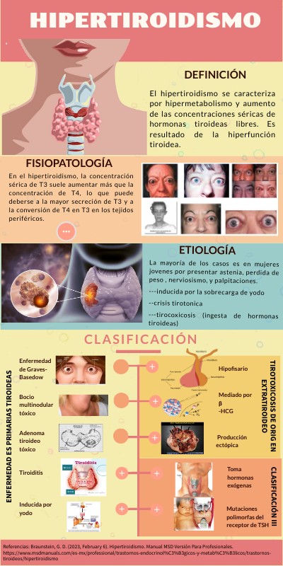 HIPERTIROIDISMO | Genially