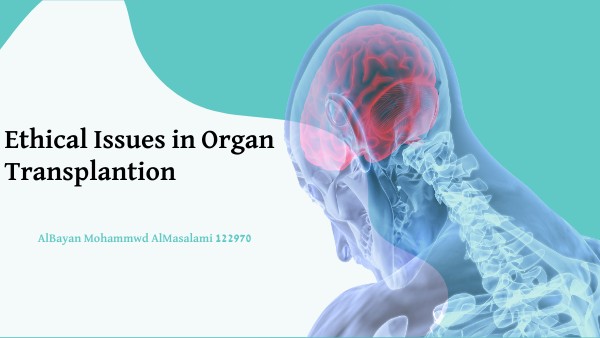 ETHICAL ISSUES IN ORGAN TRANSPLANTATION | Genially