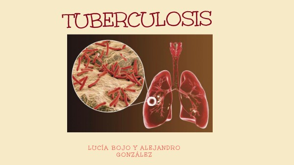PRESENTACIÓN TUBERCULOSIS