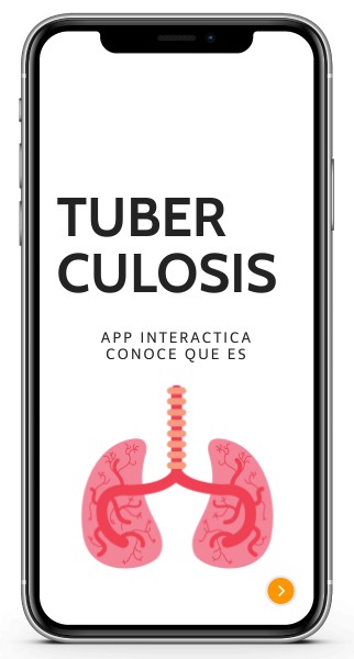 TUBERCULOSIS | Genially