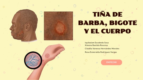 Tiña de barba, bigote y el cuerpo | Genially