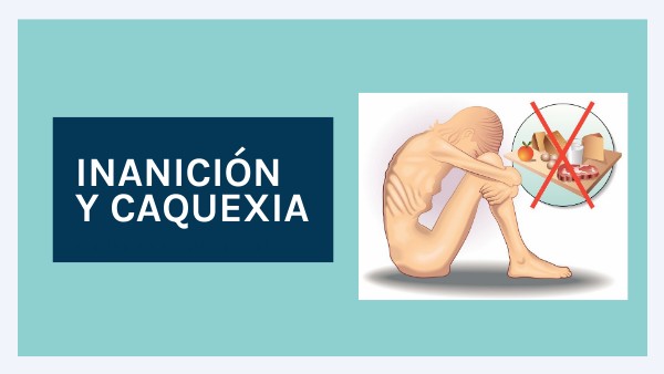 INANICIÓN Y CAQUEXIA | Genially