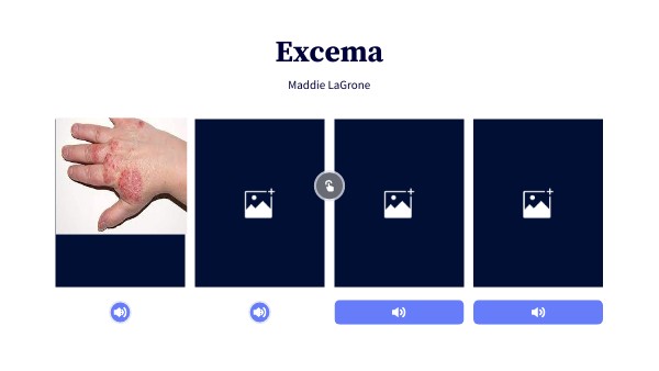 Body Systems Project- Eczema