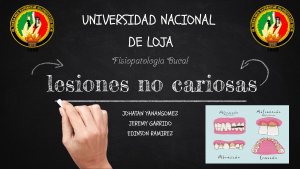 CARIES