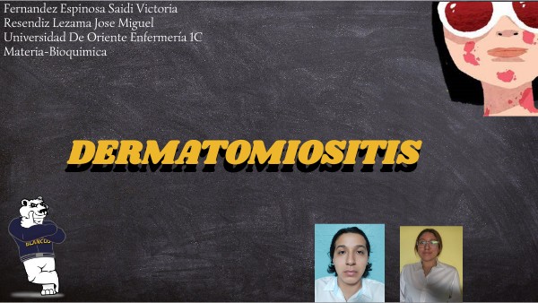Dermatomiositis
