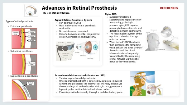 Advances in Retinal Prosthesis | Genially