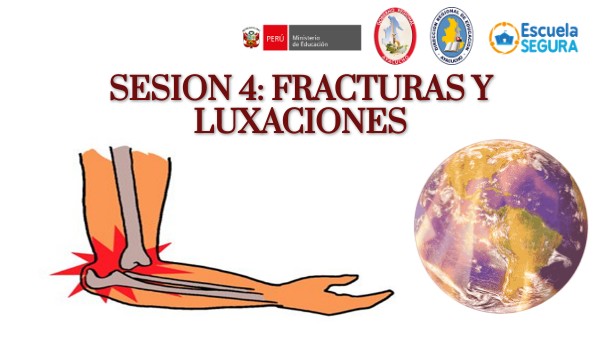 Fracturas y luxaciones | Genially