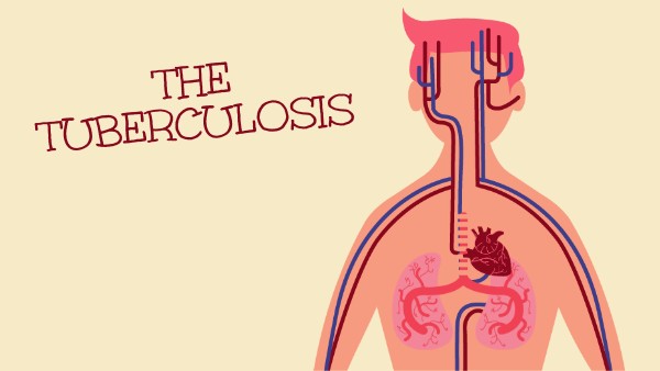 tuberculosis | Genially