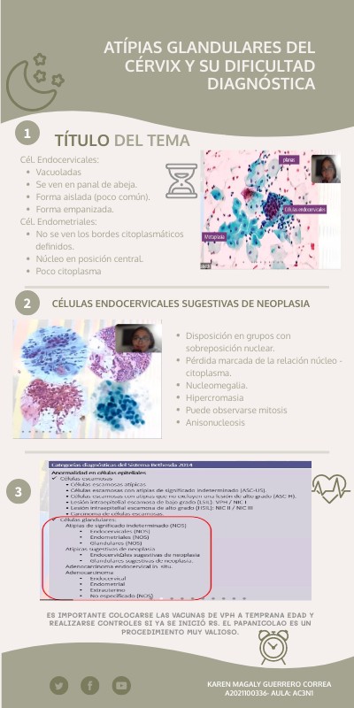 INFO ONDULADA | Genially