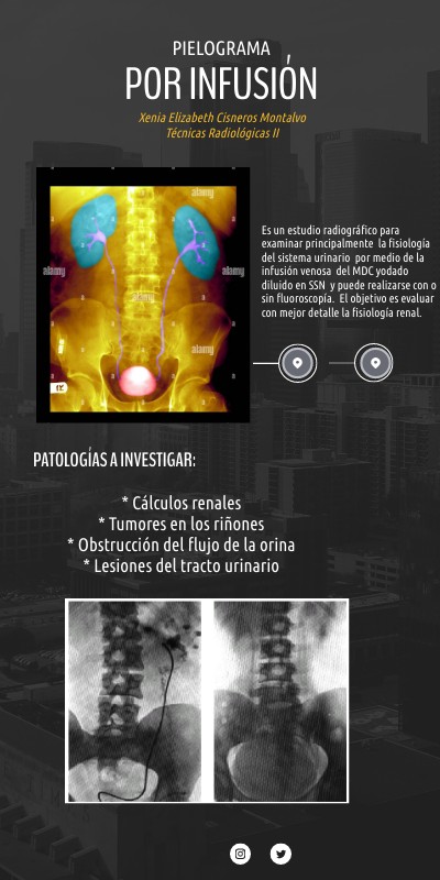 Pielograma Infusion | Genially