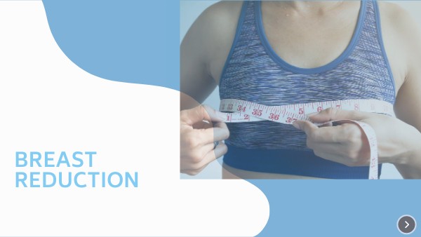 breast reduction presentation