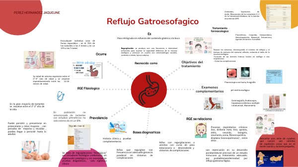 MAPA MENTAL REFLUJO GASTROESOFAGICO | Genially