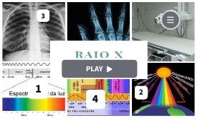 raio x