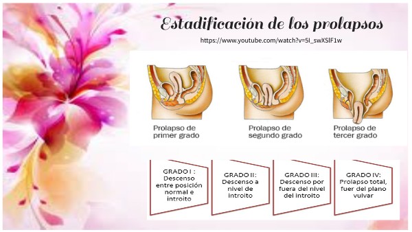 Estadificación de los prolapsos
