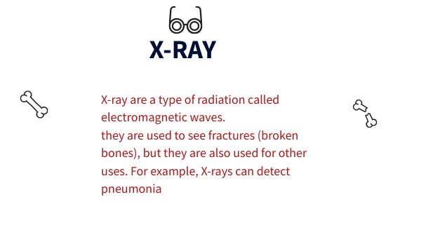 X-Ray
