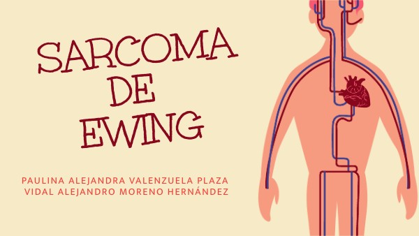 Sarcoma de ewing