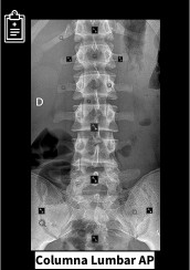 Proyección Columna Lumbar AP | Genially