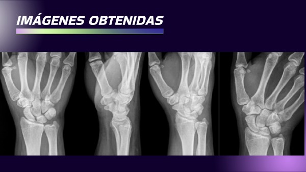 TEMA 1 MIEMBRO SUPERIOR COMPLETO | Genially