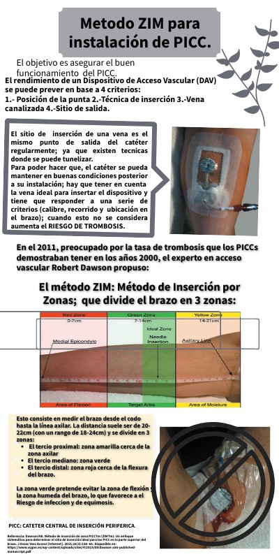 Método ZIM | Genially