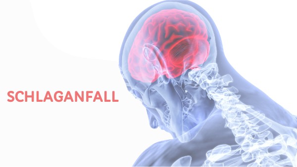 schlaganfall | Genially