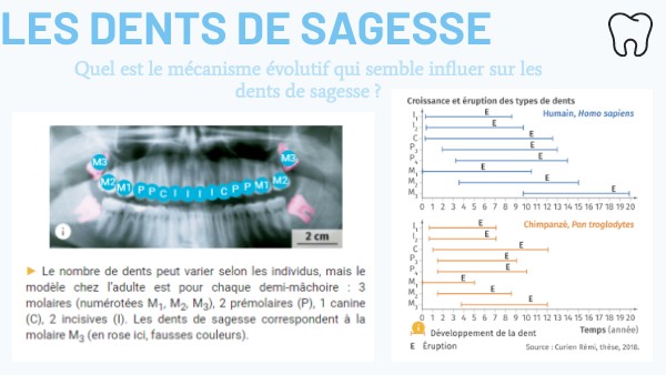 Les dents de sagesse