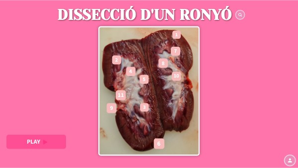 dissecion del ronyó