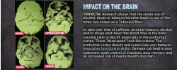 Impact on the Brain
